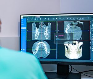 Πανοραμική - Ψηφιακή Ακτινογραφία Δοντιών - Dental Scan